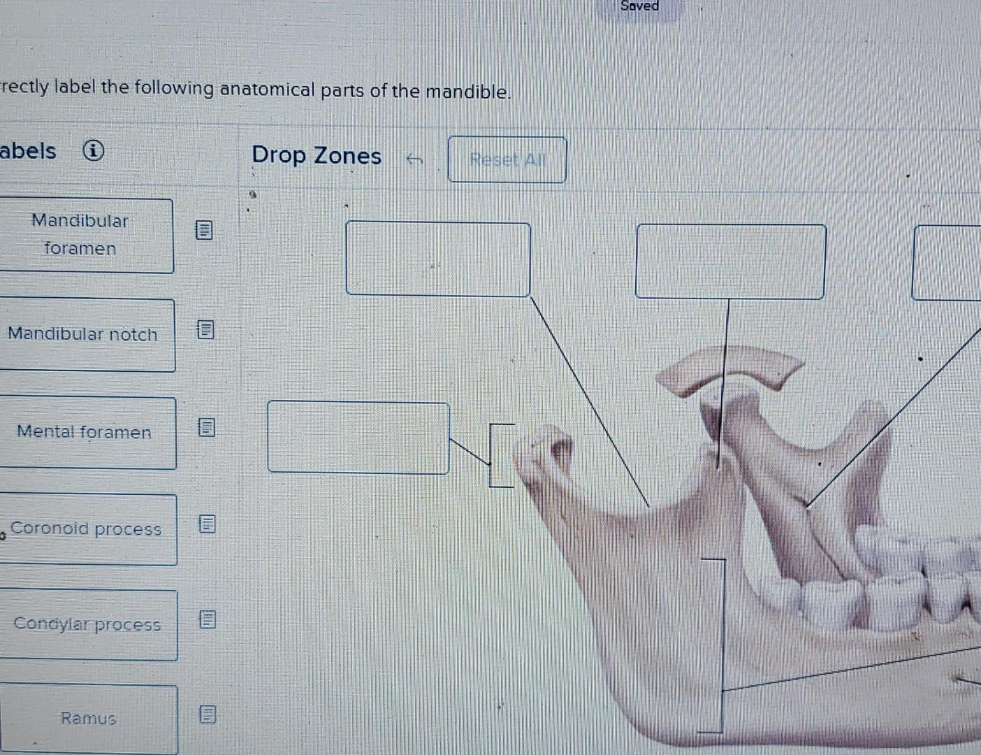 Saved rectly label the following anatomical parts of | Chegg.com