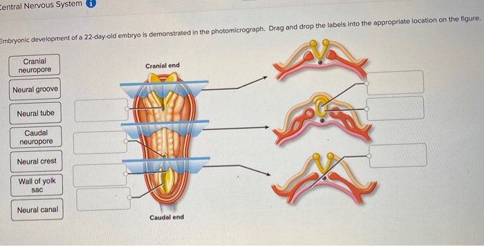 Solved Central Nervous System i Embryonic development of a | Chegg.com