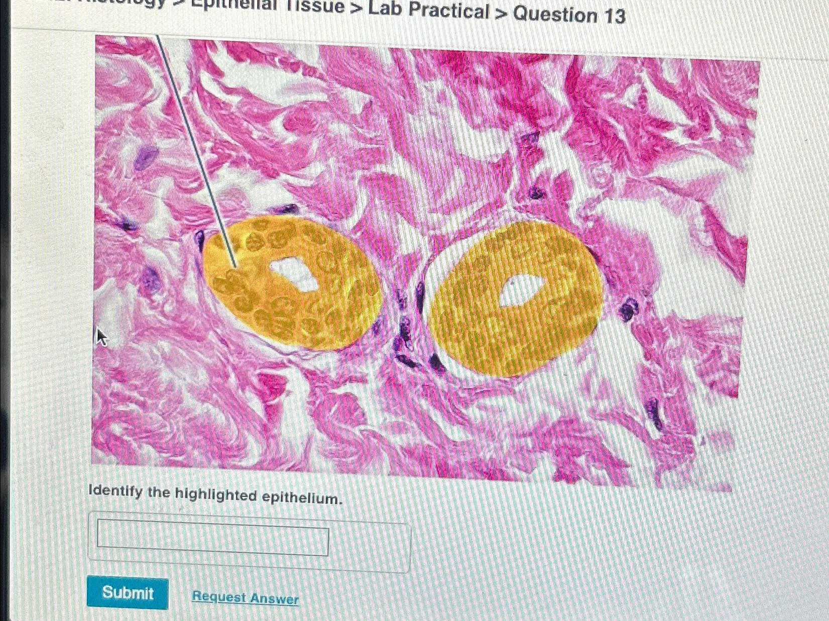 Solved ISsue > Lab Practical > Question 13Identify the | Chegg.com Solved ISsue > Lab Practical > Question 13Identify the | Chegg.com