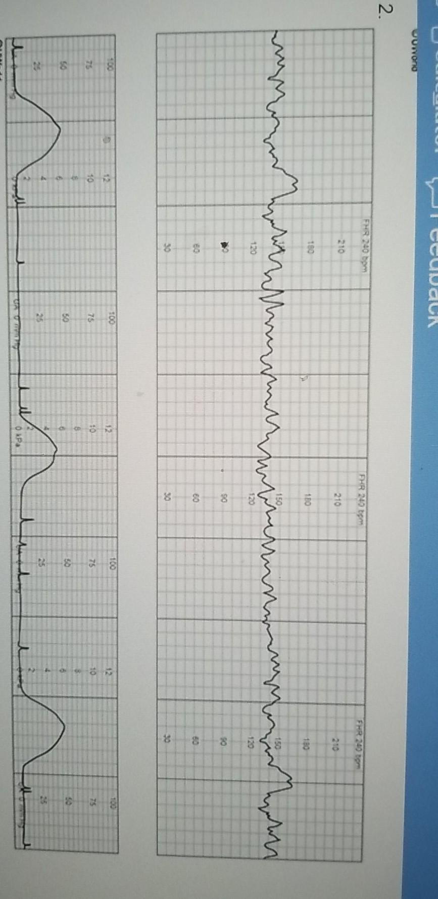 Solved e is caring for a client at 37 weeks gestation who is | Chegg.com
