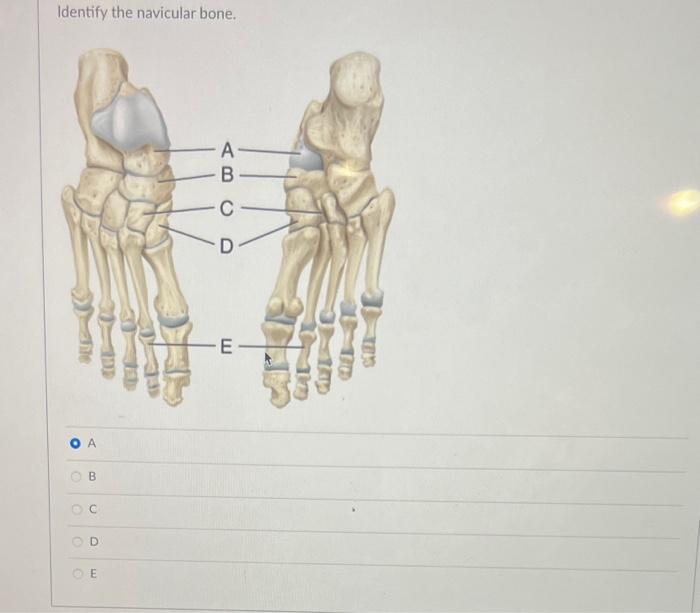 Solved Identify the navicular bone. | Chegg.com