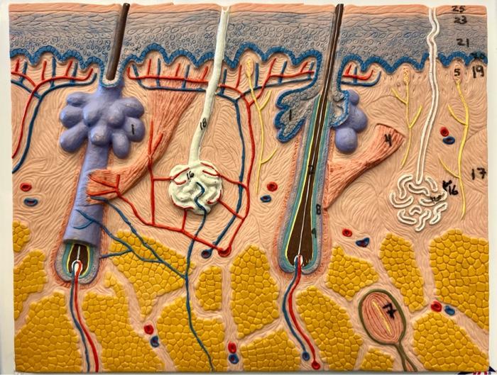 Solved Label this model of the skin. | Chegg.com