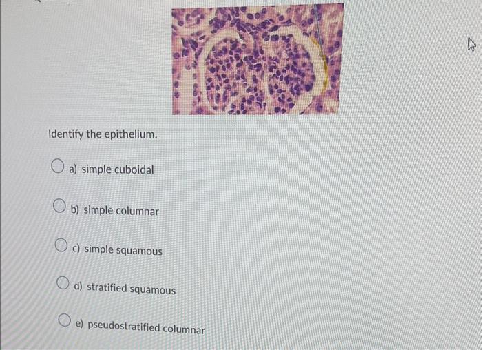 Solved Identify the epithelium. a) simple cuboidal b) simple | Chegg.com