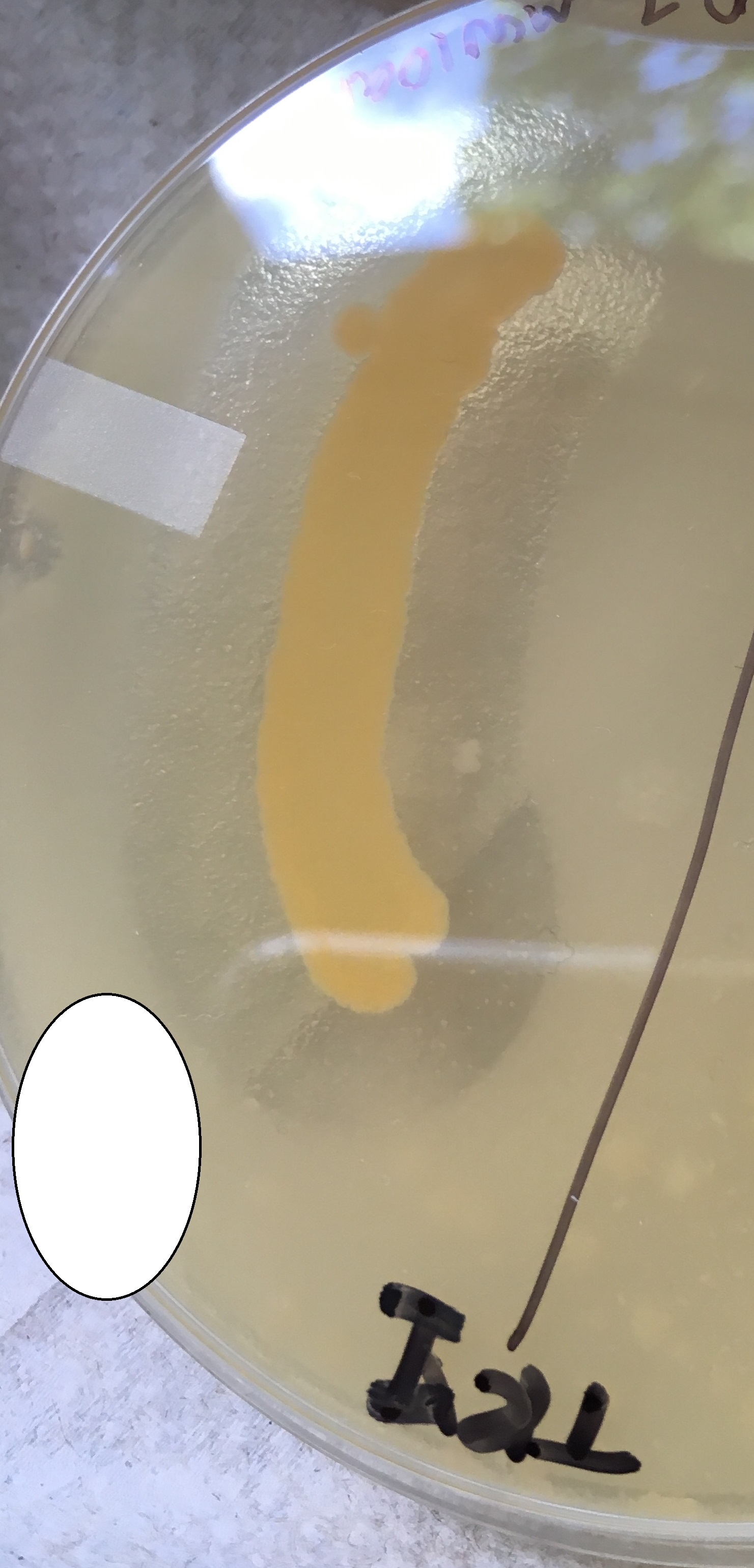 Solved Tributyrin TributWhat enzymes are used in this | Chegg.com