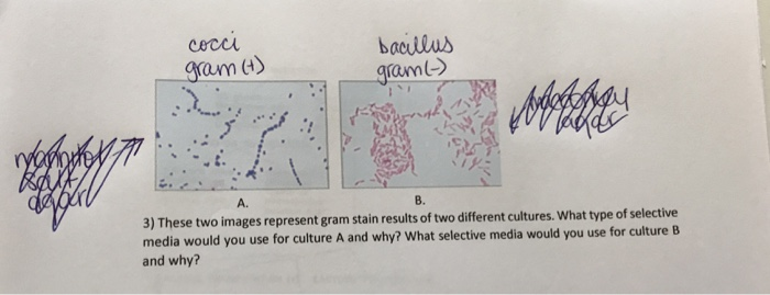 Solved cocci gram (H) bacillus gram(-) deu nanotte BOZI | Chegg.com