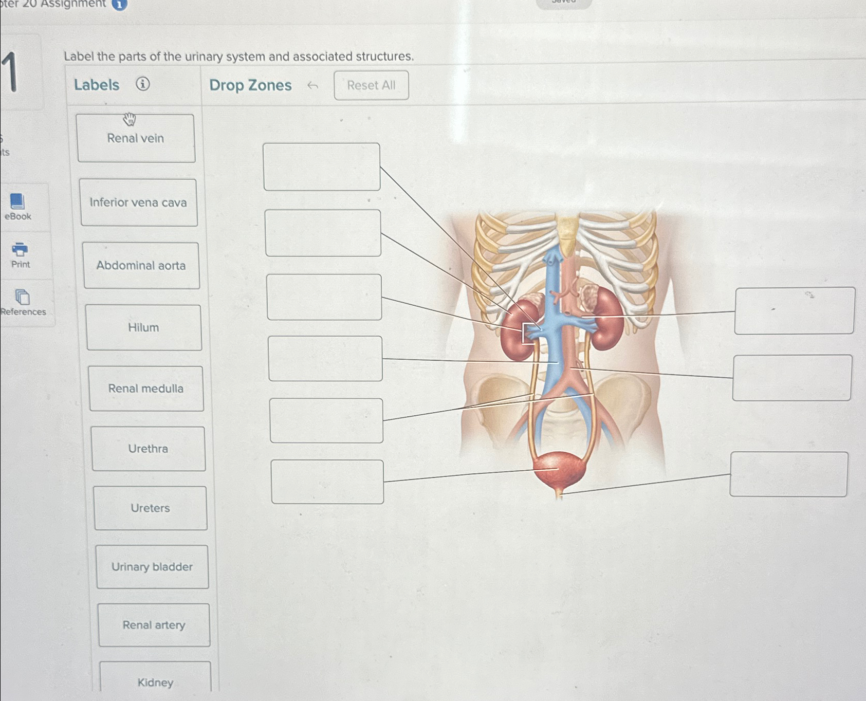 Solved 1 ﻿Label the parts of the urinary system and | Chegg.com