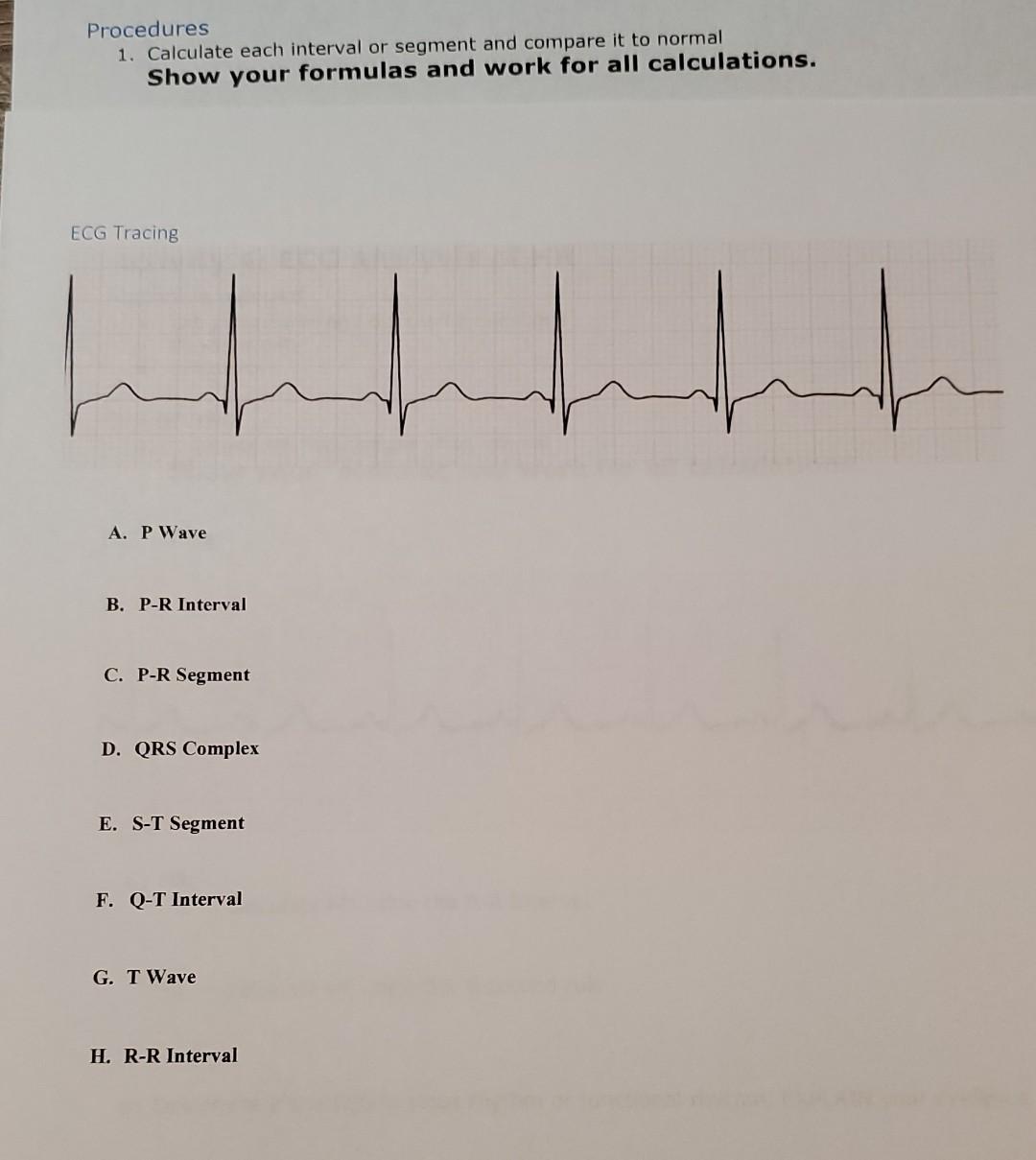 Solved Procedures 1. Calculate each interval or segment and | Chegg.com