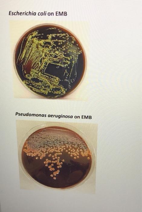 Pseudomonas Aeruginosa Emb Agar