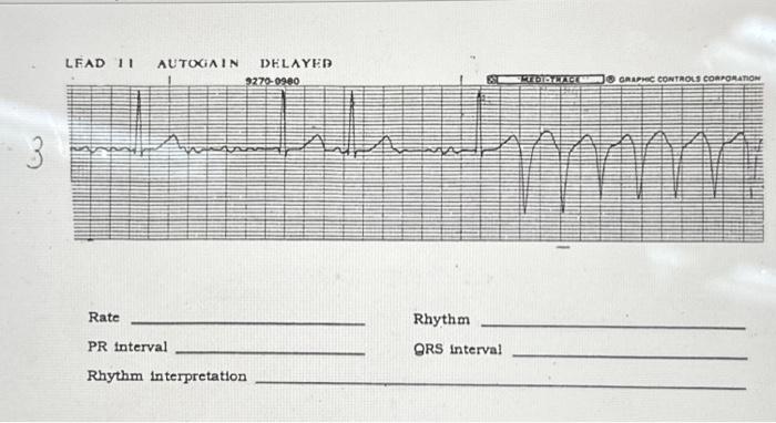 Solved 3 LEAD 11 AUTOGAIN DELAYED myt Rate PR interval | Chegg.com