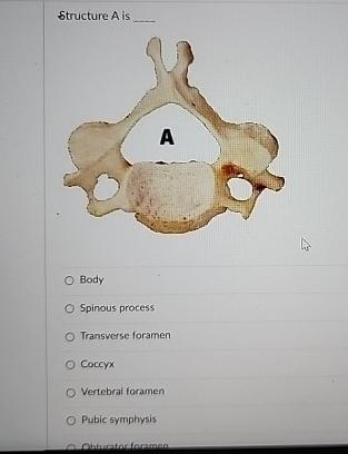 Solved Structure A ﻿isBodySpinous processTransverse | Chegg.com