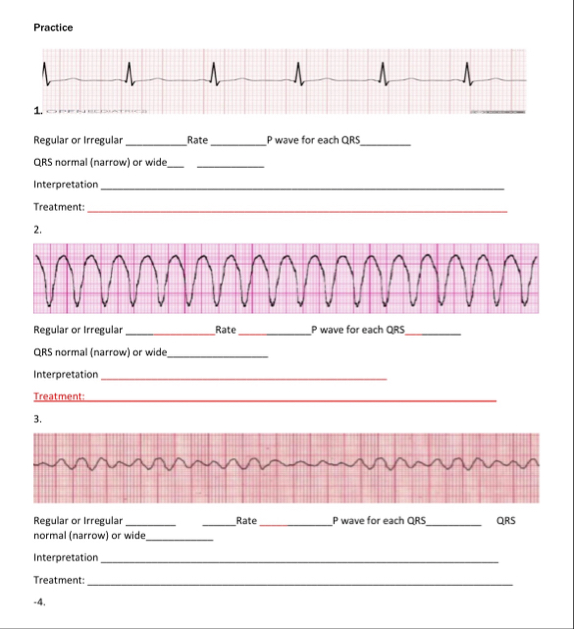 Practice1Regular or Irregular . ﻿Rate P wave for each | Chegg.com