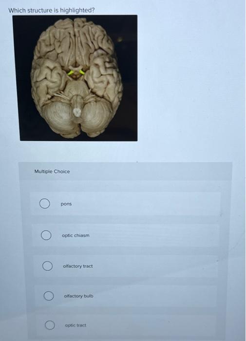 Solved The structure highlighted represents? Multiple Choice | Chegg.com