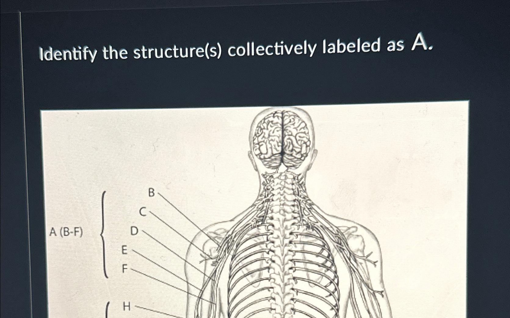 Solved Identify the structure(s) ﻿collectively labeled as A. | Chegg.com