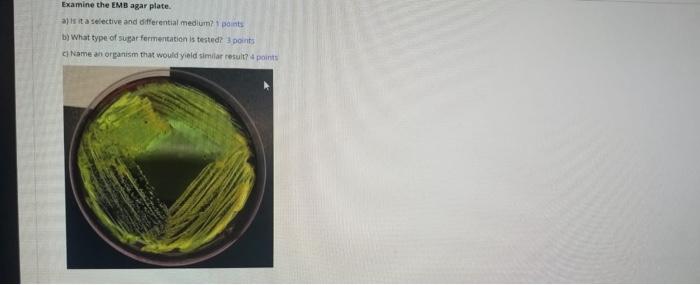 Solved Examine the EMB agar plate. as it a selective and | Chegg.com