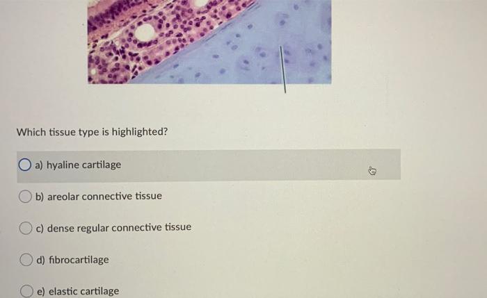 Solved Which tissue type is highlighted? O a) hyaline | Chegg.com