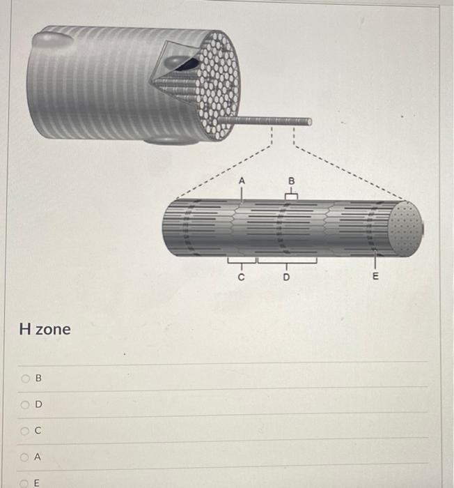 Solved A D E H zone B D Ос СА Ο Ε | Chegg.com