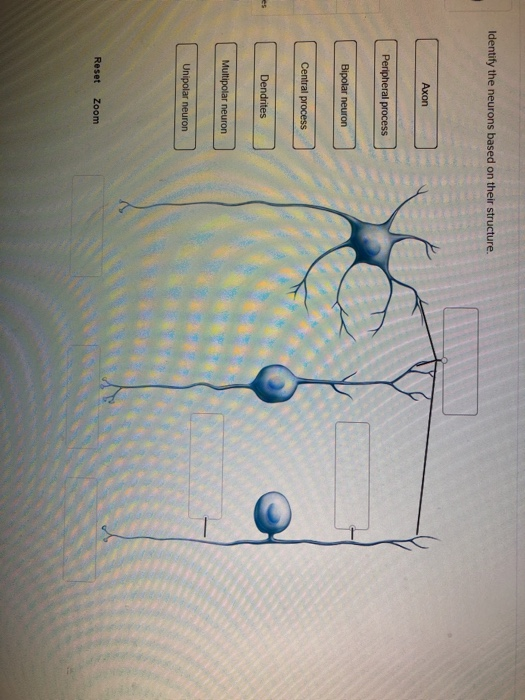 Solved Identify the neurons based on their structure. Axon | Chegg.com
