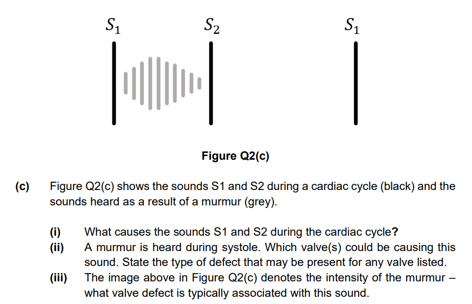 Solved (c) ﻿Figure Q2(c) ﻿shows the sounds S1 ﻿and S2 | Chegg.com