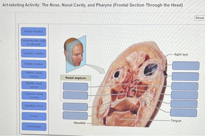 Solved Art-labeling Activity: The Nose, Nasal Cavity, and | Chegg.com