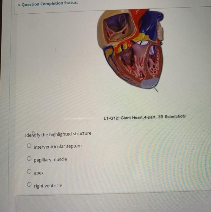 Solved Question Completion Status: LT-G12: Giant Heart, | Chegg.com