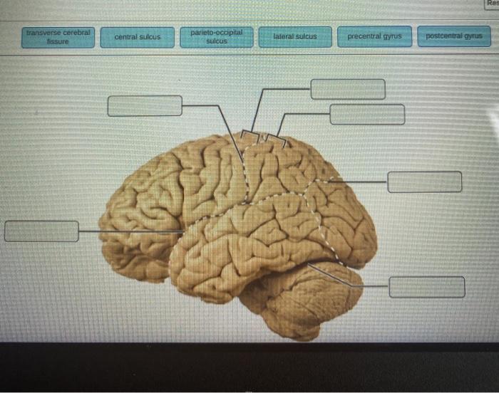 Solved ROS transverse cerebral fissure central sulcus | Chegg.com