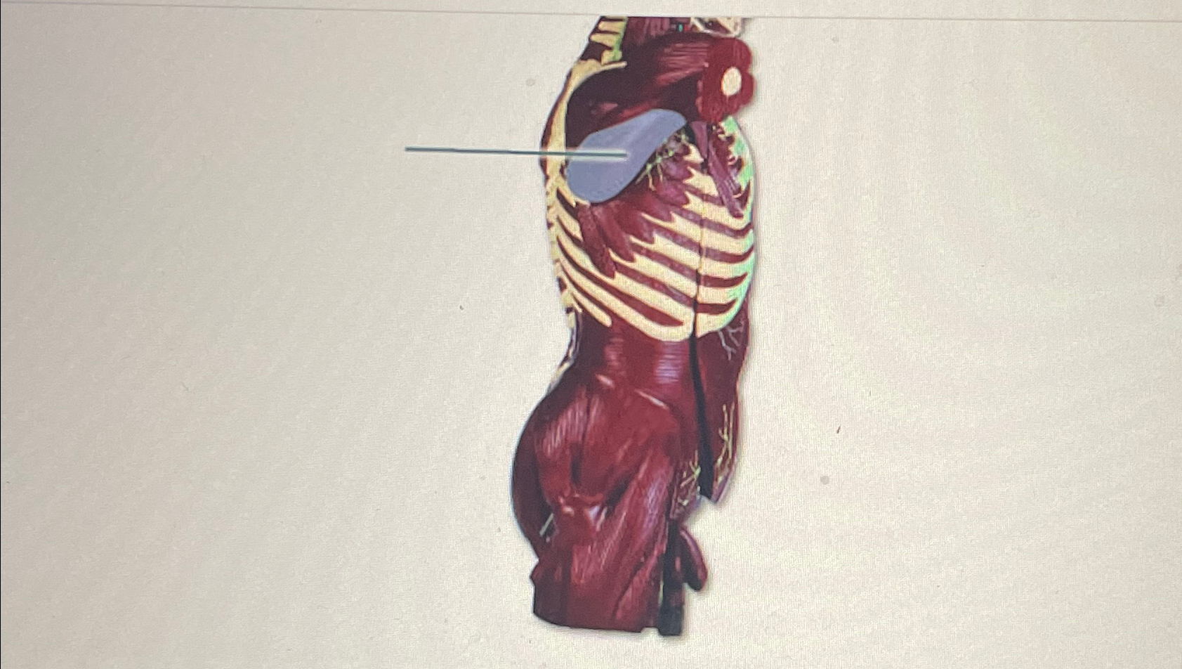 Solved Identify the highlighted muscle | Chegg.com