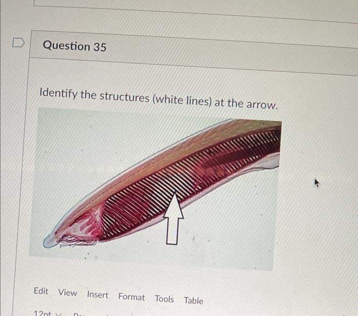 Solved Identify the structures at the arrow. Edit View | Chegg.com