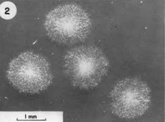 Solved Identify the colony margin:A) entireB) filamentousC) | Chegg.com