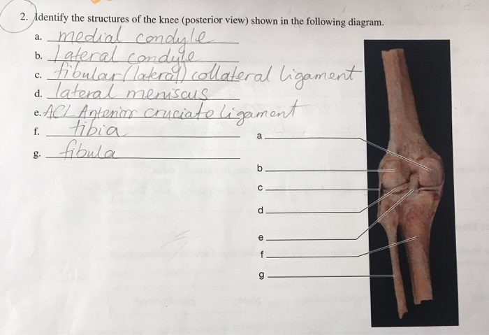 Solved 2. Identify the structures of the knee (posterior | Chegg.com