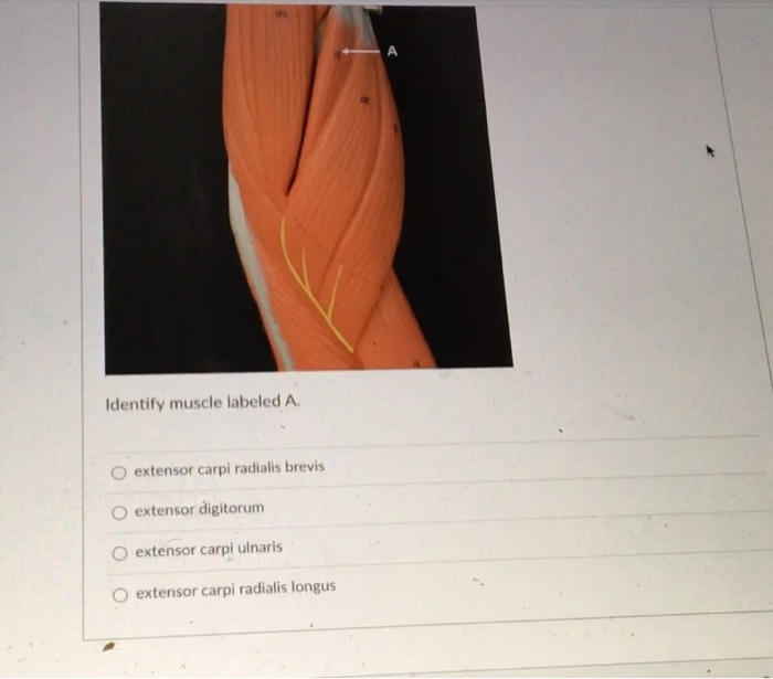 Solved The origin for the muscle arrow is pointing to is | Chegg.com