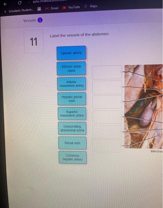 Solved Label the vessels of the abdomen the abdomen. Label | Chegg.com