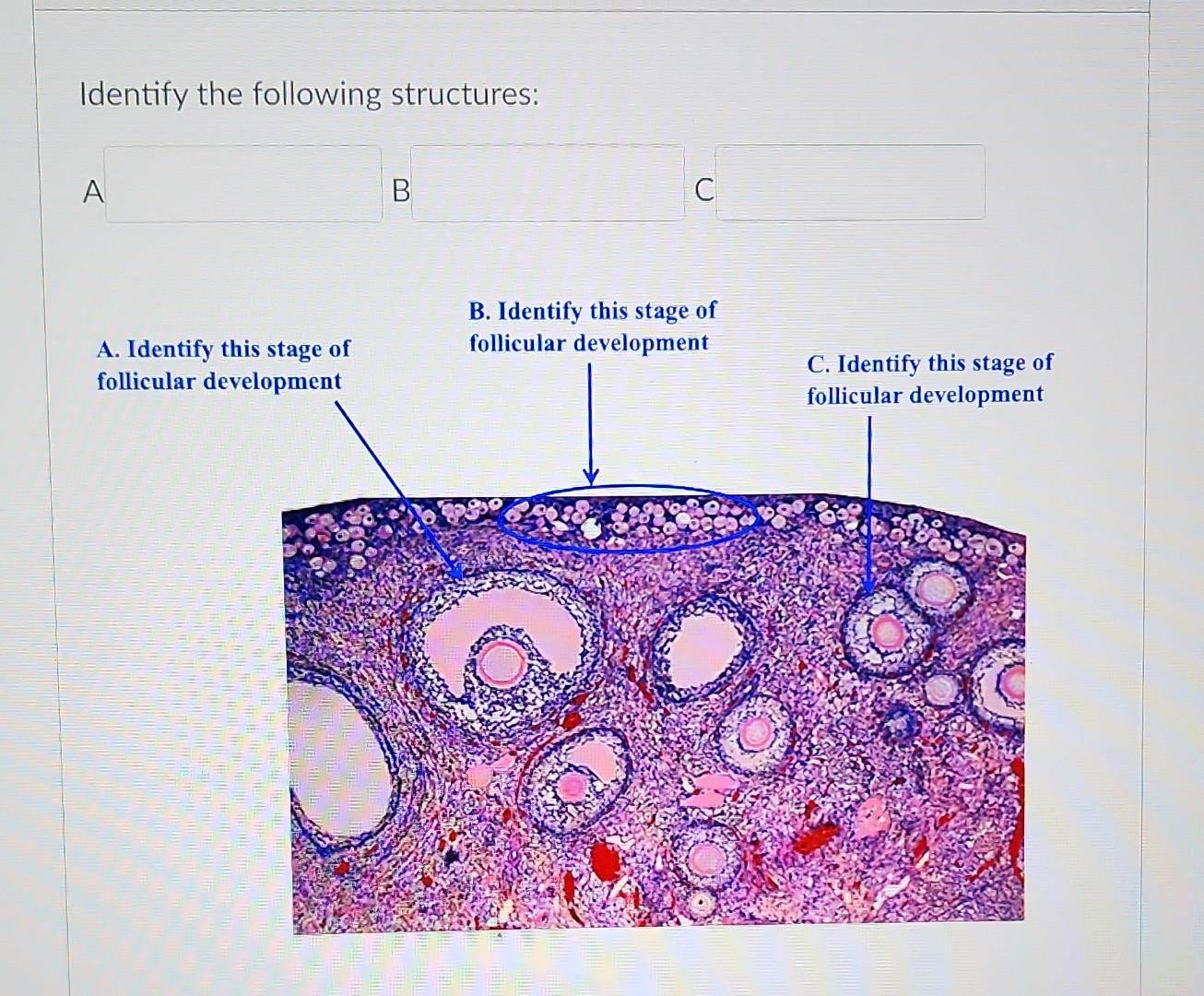 Solved Identify the following structures: B. Identify this | Chegg.com