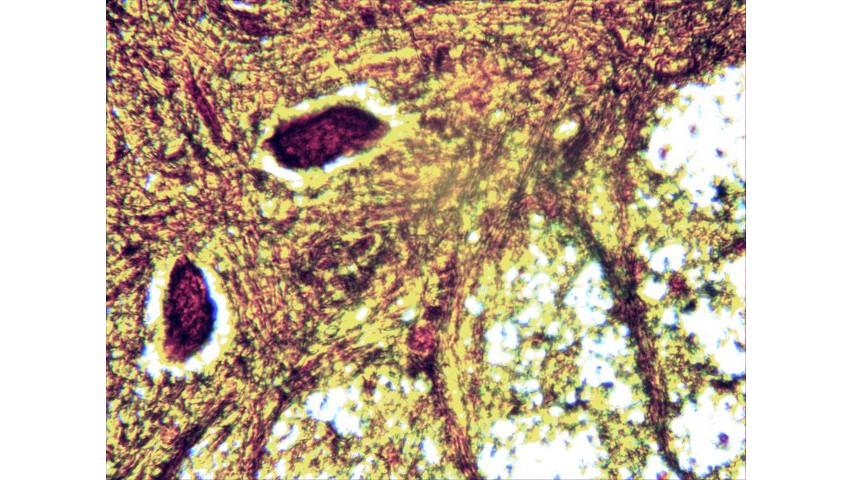 Solved Label the white matter, gray matter, and a neuron | Chegg.com