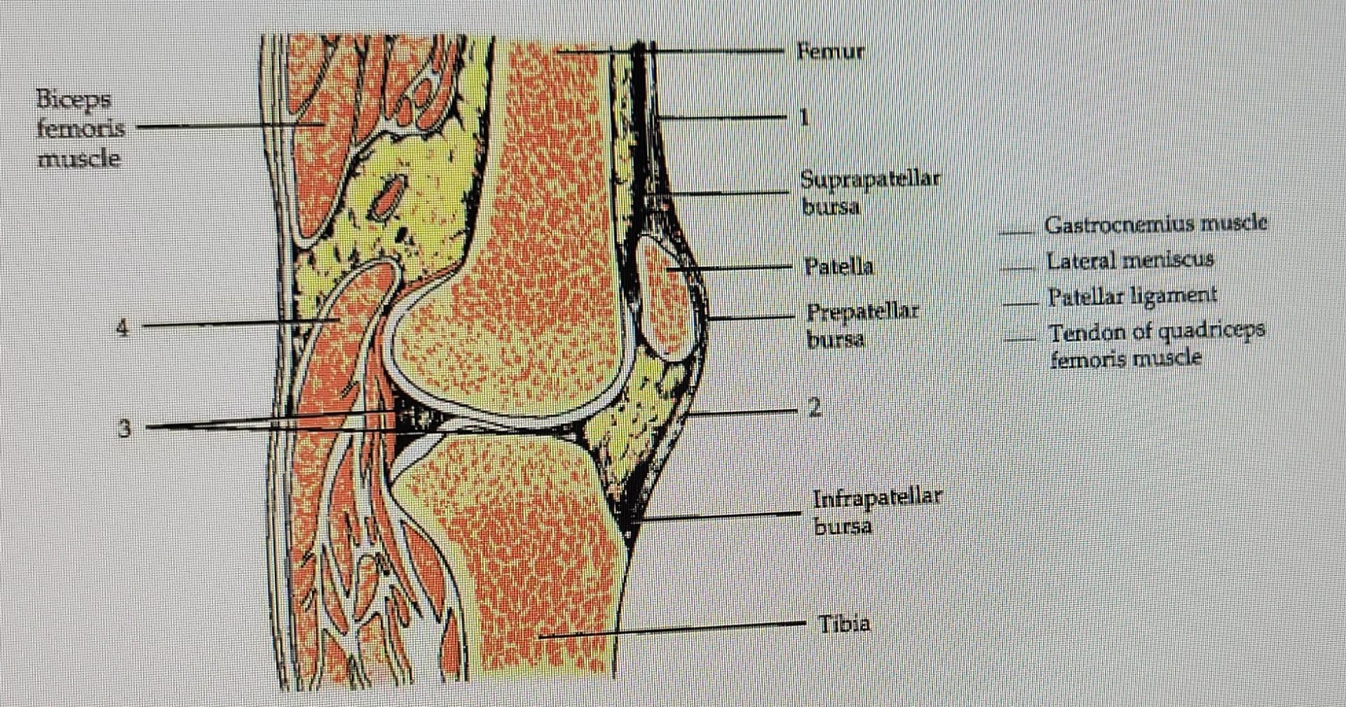 Solved Femur Biceps femoris muscle Suprapatellar Palella | Chegg.com