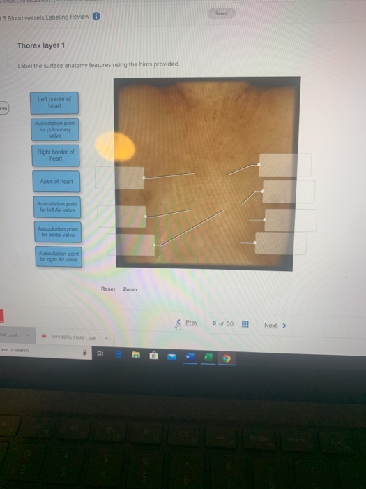 Solved 15 Blood vessels Labeling Review Thorax layer 1 Label | Chegg.com