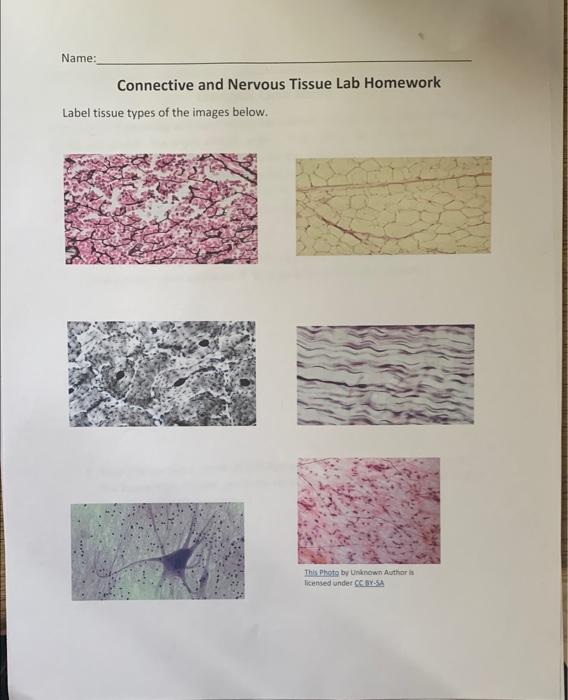 Solved Name: Connective and Nervous Tissue Lab Homework | Chegg.com
