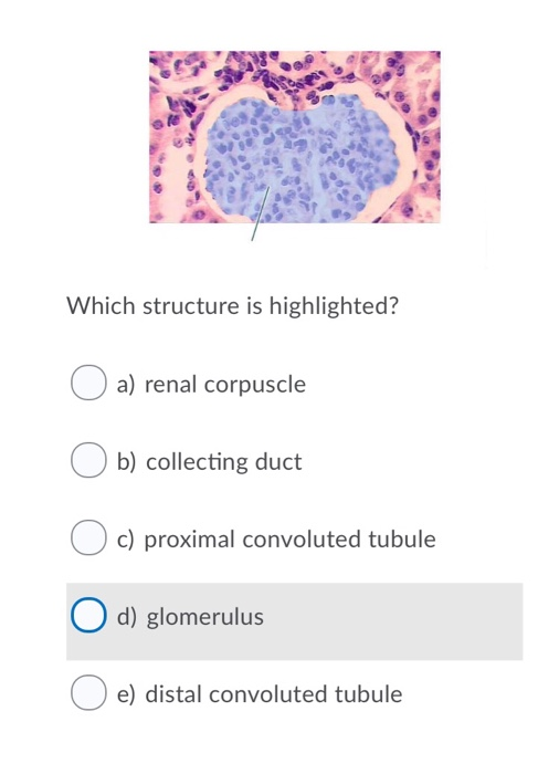 Solved Which structure is highlighted? a) renal corpuscle b) | Chegg.com