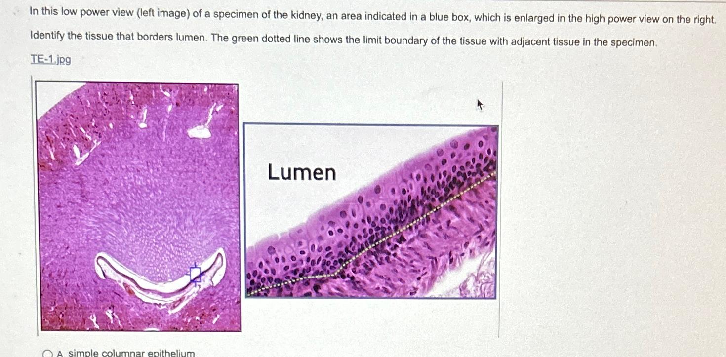 In This Low Power View Left Image ﻿of A Specimen Of