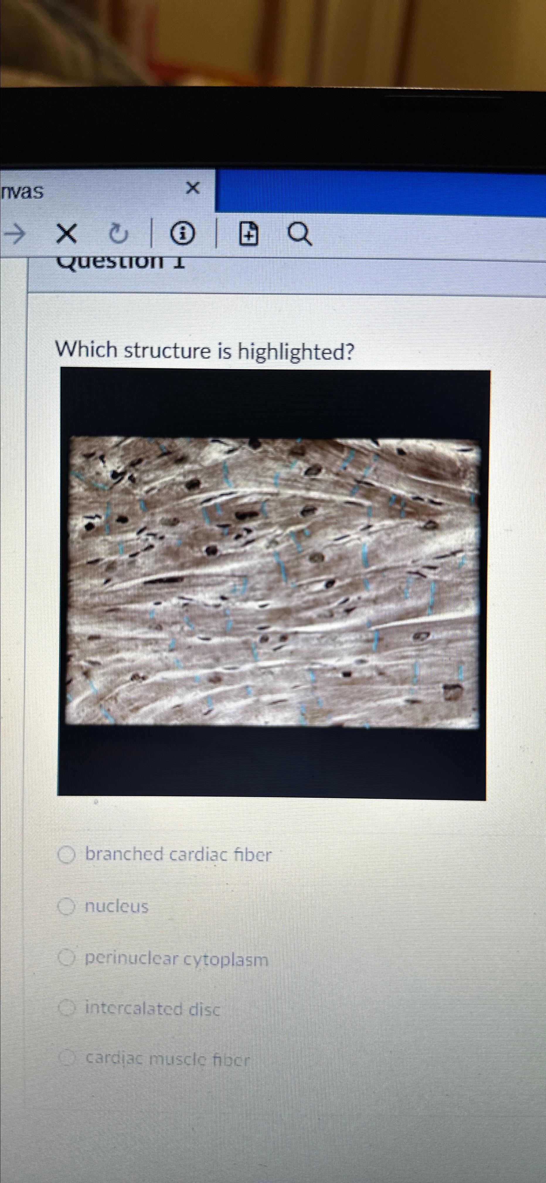 Solved Which structure is highlighted?branched cardiac | Chegg.com