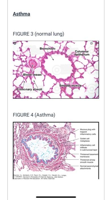 Asthma Histology