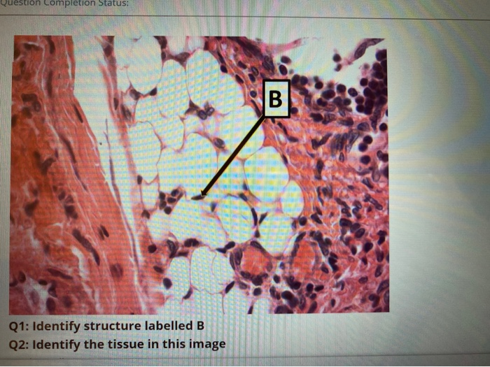 Solved question completion Status: Q1: Identify structure | Chegg.com