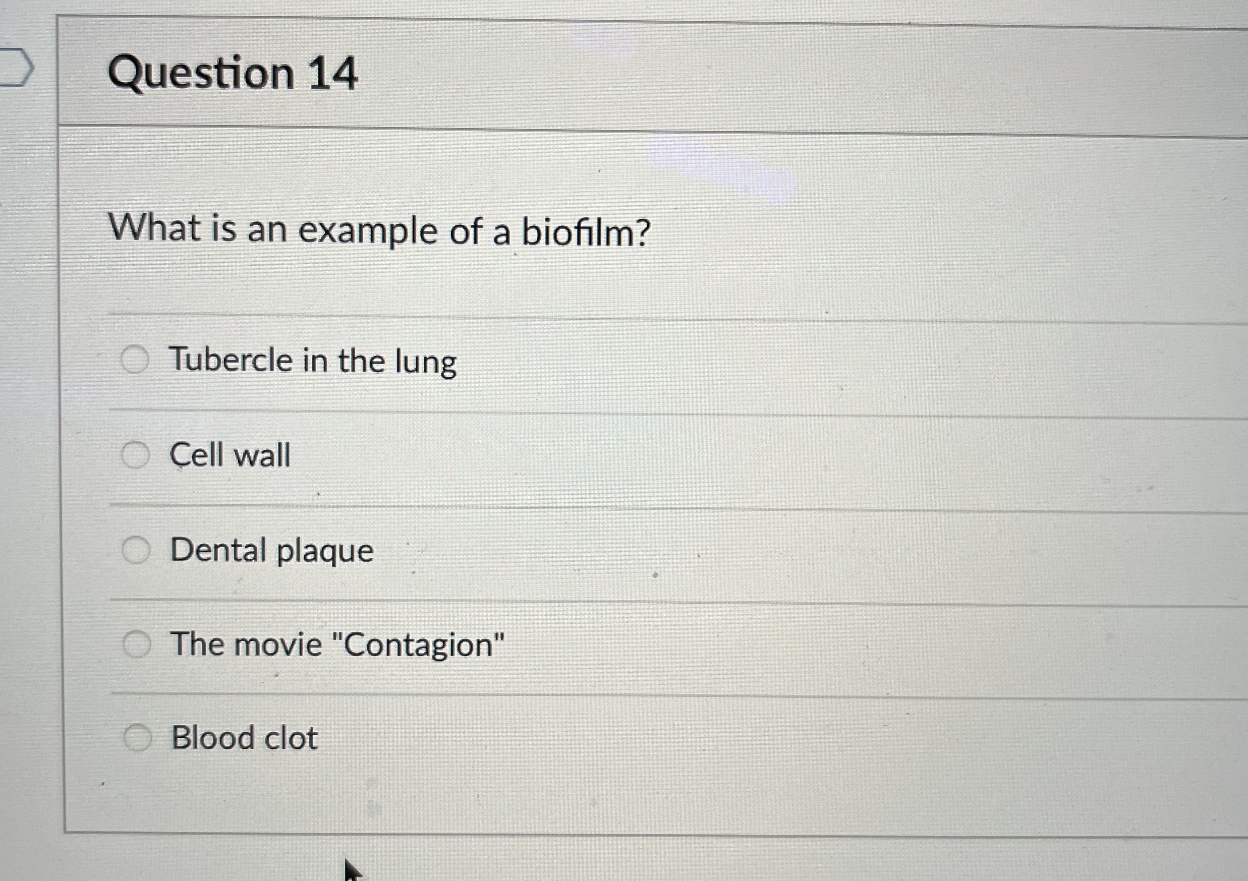Solved Question 14What is an example of a biofilm?Tubercle | Chegg.com