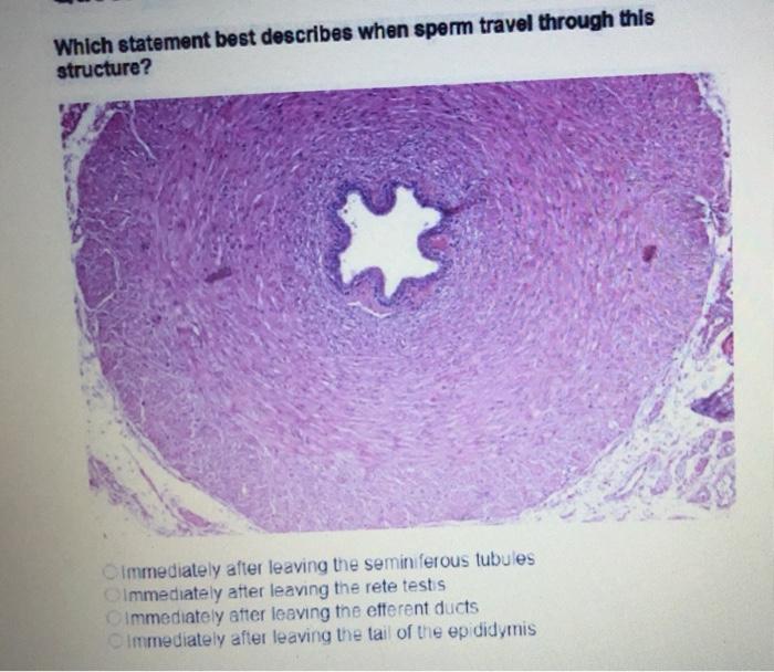 Solved Which statement best describes when sperm travel | Chegg.com