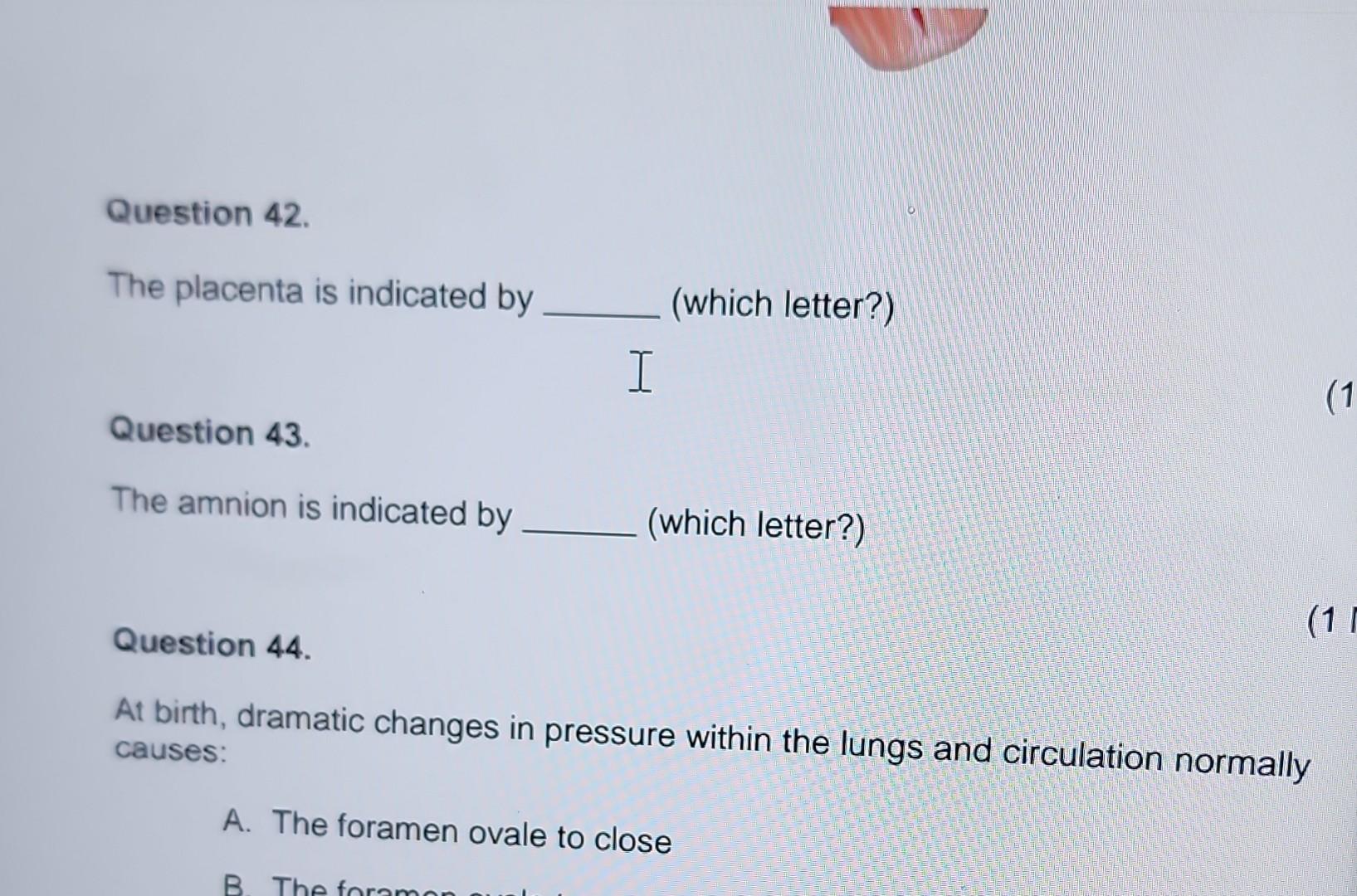 Solved Question 42. The placenta is indicated by (which | Chegg.com
