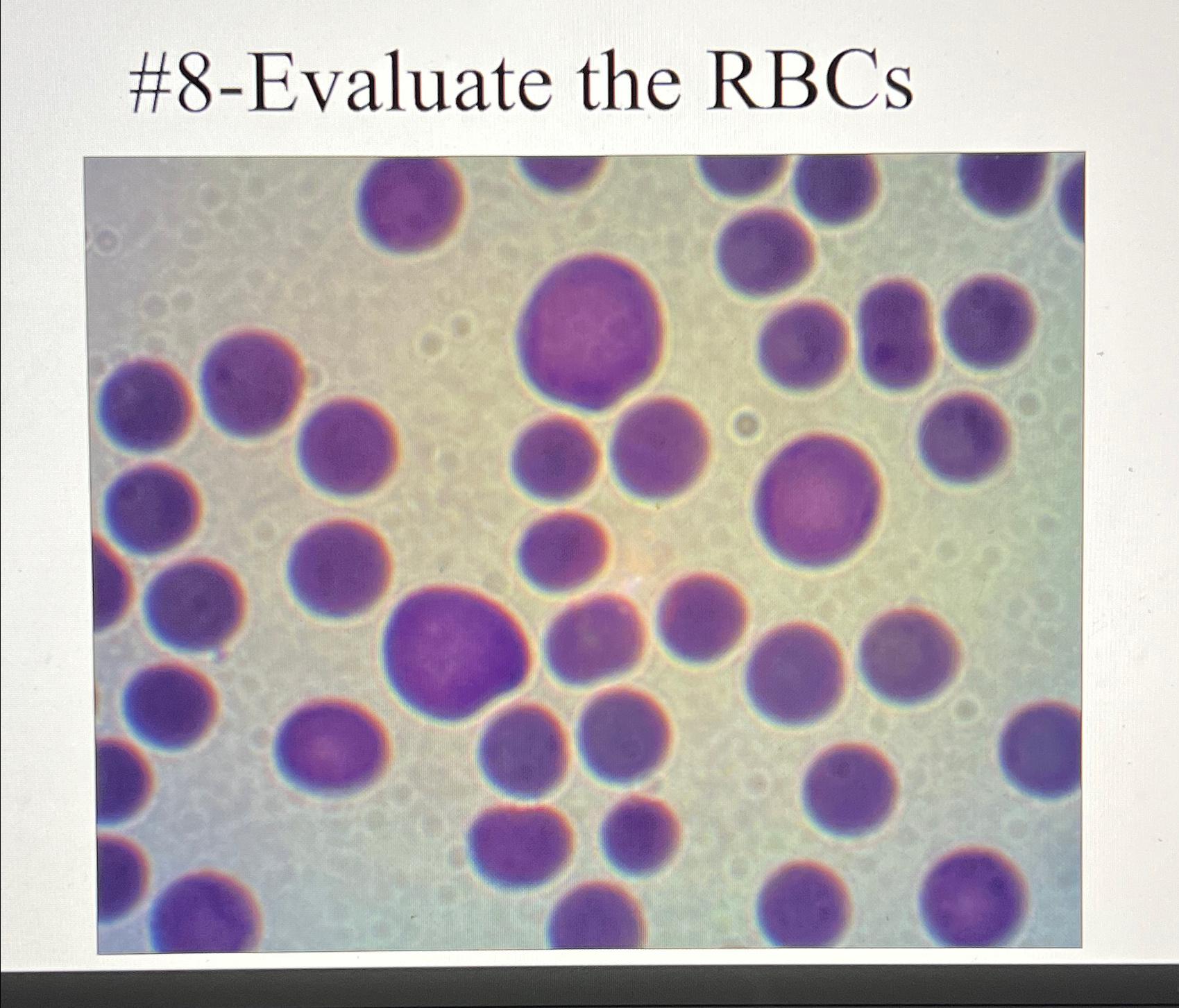 Solved #8-Evaluate the RBCs | Chegg.com Solved #8-Evaluate the RBCs | Chegg.com