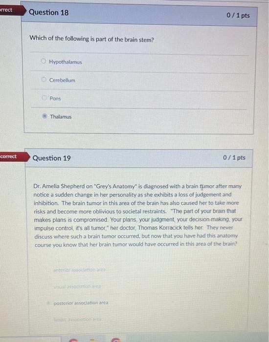 Solved Which of the following is part of the brain stem? | Chegg.com