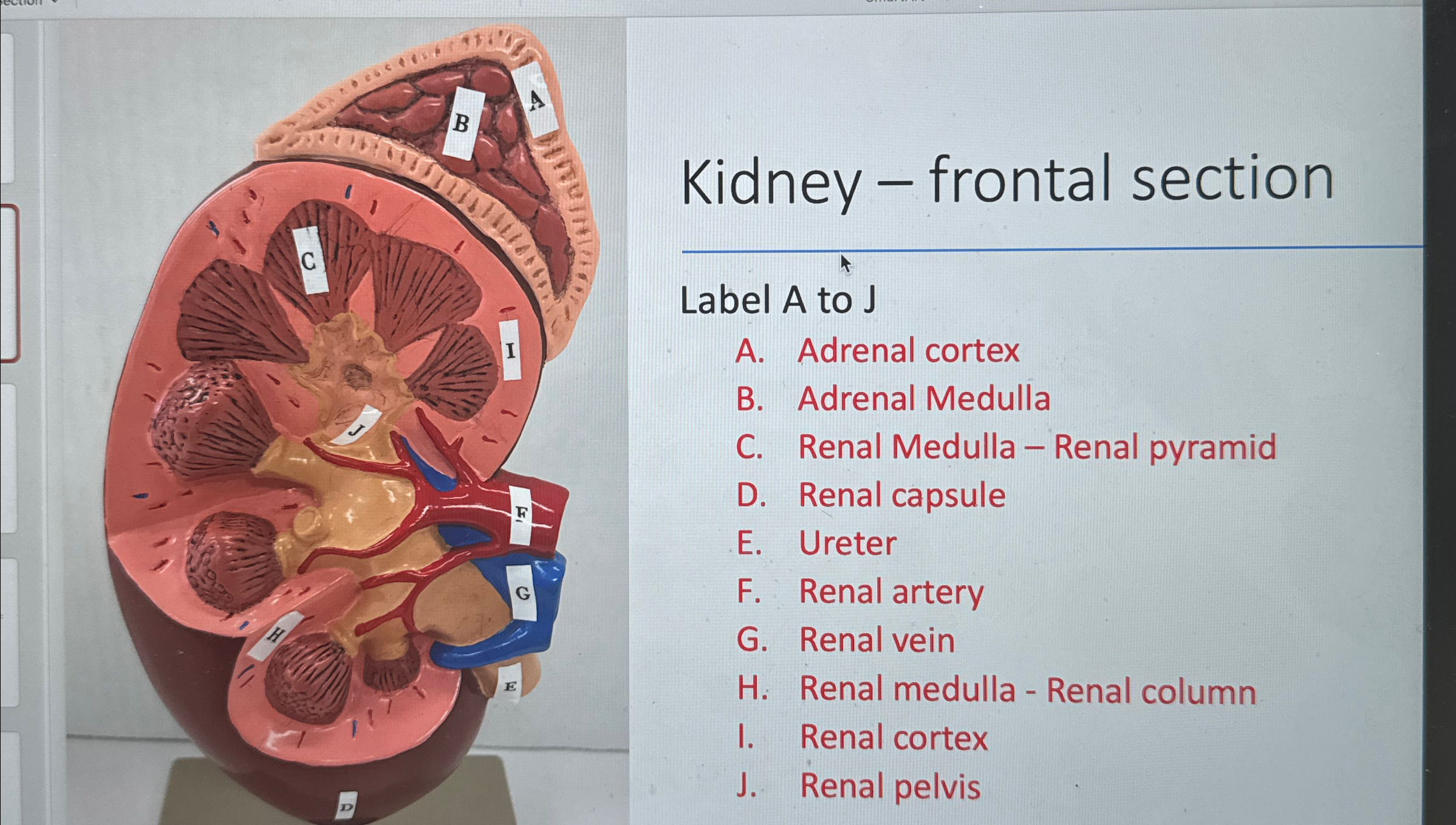 Solved Kidney - ﻿frontal sectionLabel A to JA. ﻿Adrenal | Chegg.com