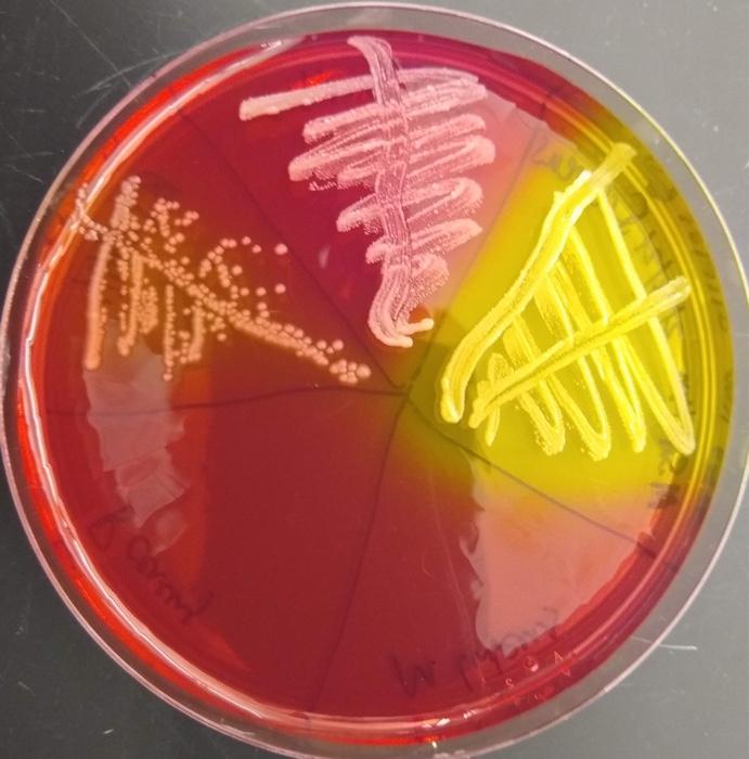 Solved VW Mannitol Salt Plates Organism Growth Color of | Chegg.com