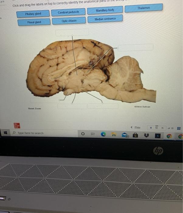 Solved of 4 Click and drag the labels on top to correctly | Chegg.com