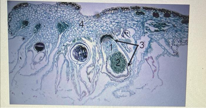 Solved 1) This stalk-like structure is called a(n) 2) Name | Chegg.com
